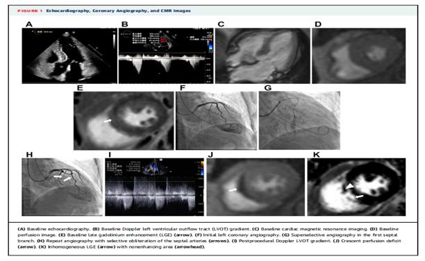深耕二十载，贵州省人民医院心内科原创技术发表心血管病顶级期刊JACC-Cardiovascular interventions